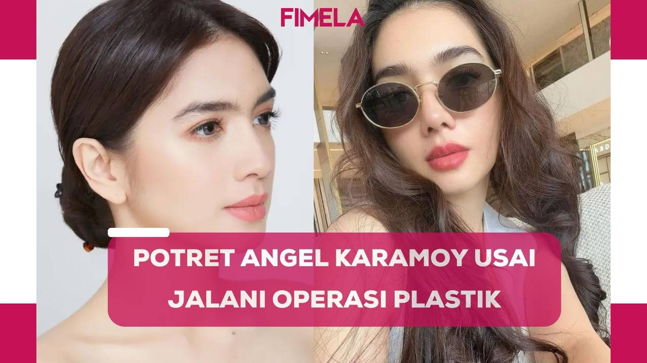 6 Potret Penampilan Baru Angel Karamoy setelah Operasi Plastik di ...