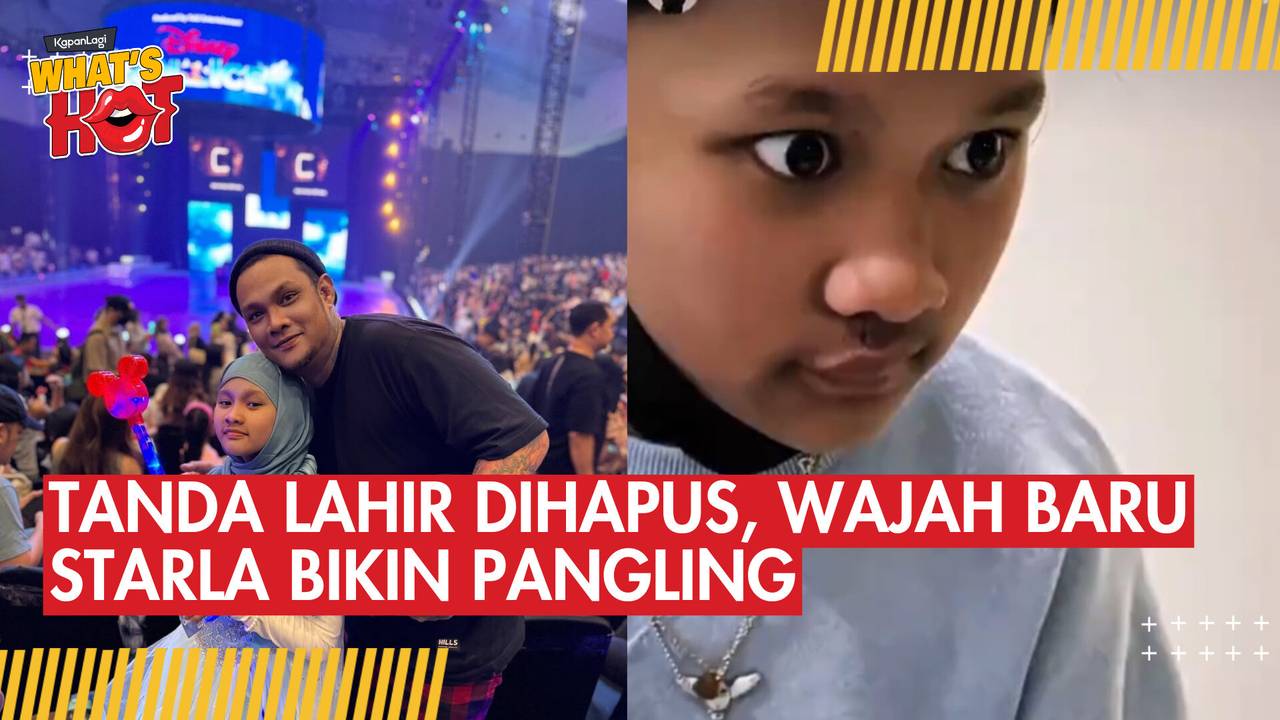 Starla Rhea Idola Hilangkan Tanda Lahir, Virgoun Tunjukkan Penampilan ...