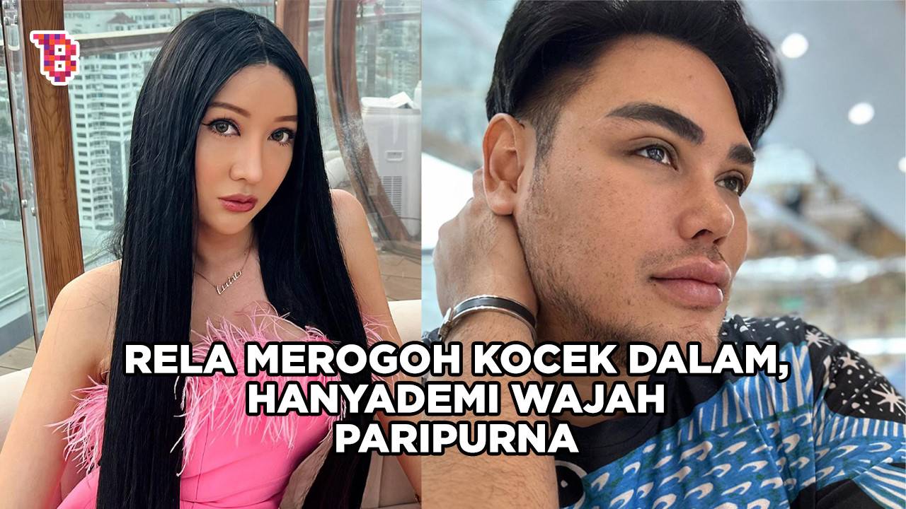 Potret 9 seleb sebelum dan sesudah operasi plastik, perubahan wajah ...