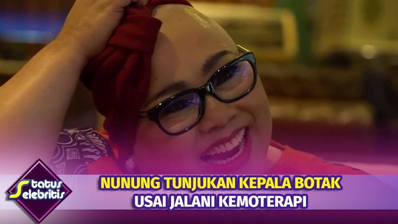 Tegar!! Nunung Tunjukan Kepala Botak Pasca Kemo | Status Selebriti | Vidio