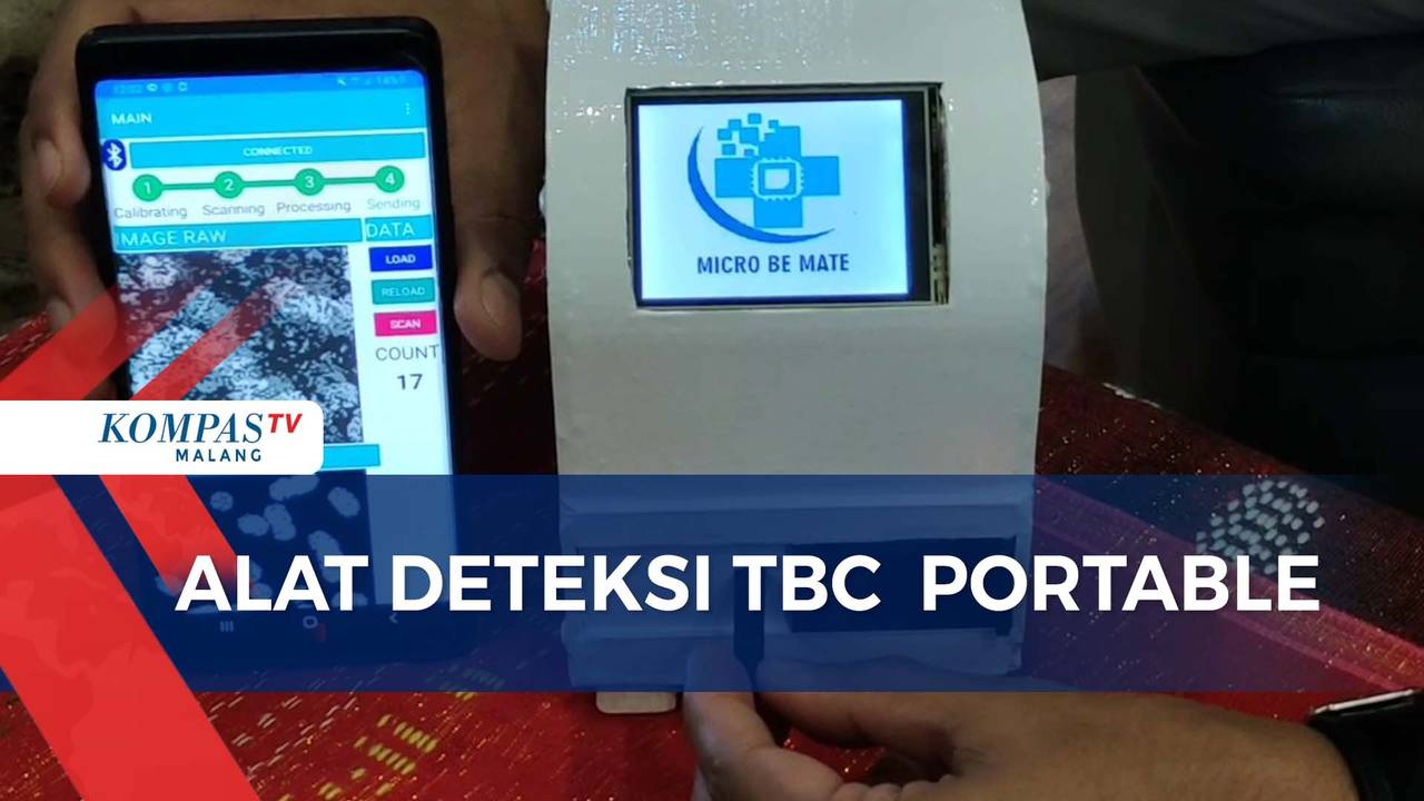 Keren! Mahasiswa di Malang Buat Alat Deteksi TBC Portable - Kompas TV | Vidio