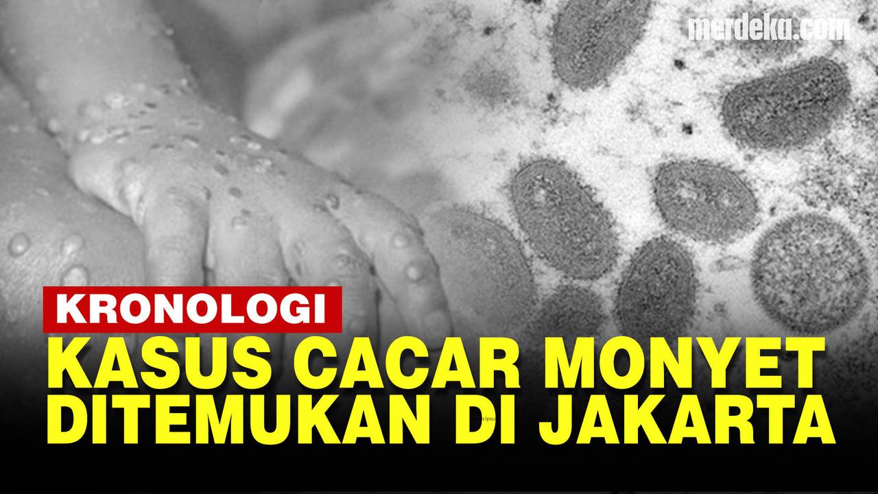 Ditemukan di Indonesia, Catat! Ini Ciri-Ciri Terkena Cacar Monyet Atau ...