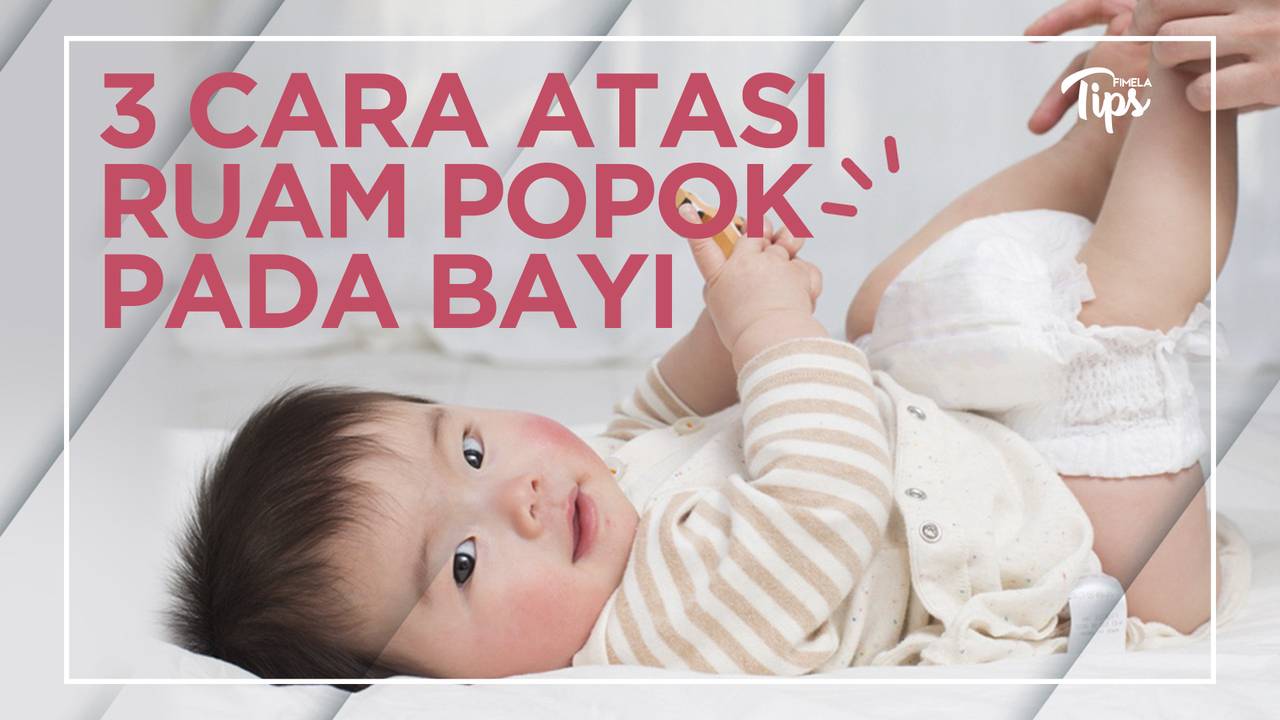 Cara Ampuh Mengatasi Ruam Popok pada Bayi | Vidio
