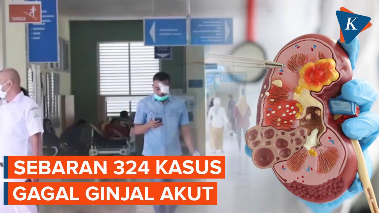 Sebaran Kasus Gagal Ginjal Akut Di 27 Provinsi Kompascom Vidio