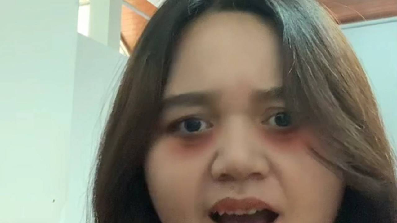 NOTED KAK! Ketika Proposal Tak Kunjung di ACC - Shorts