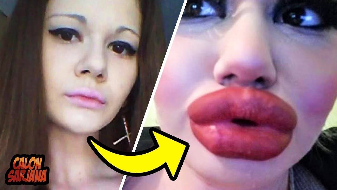 Habiskan Lebih dari Rp 50 Juta Untuk Memiliki Bibir Terbesar di Dunia ...