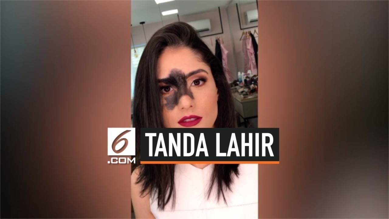 MARIANA MENDES, MODEL CANTIK DENGAN TANDA LAHIR BESAR DI WAJAH ...