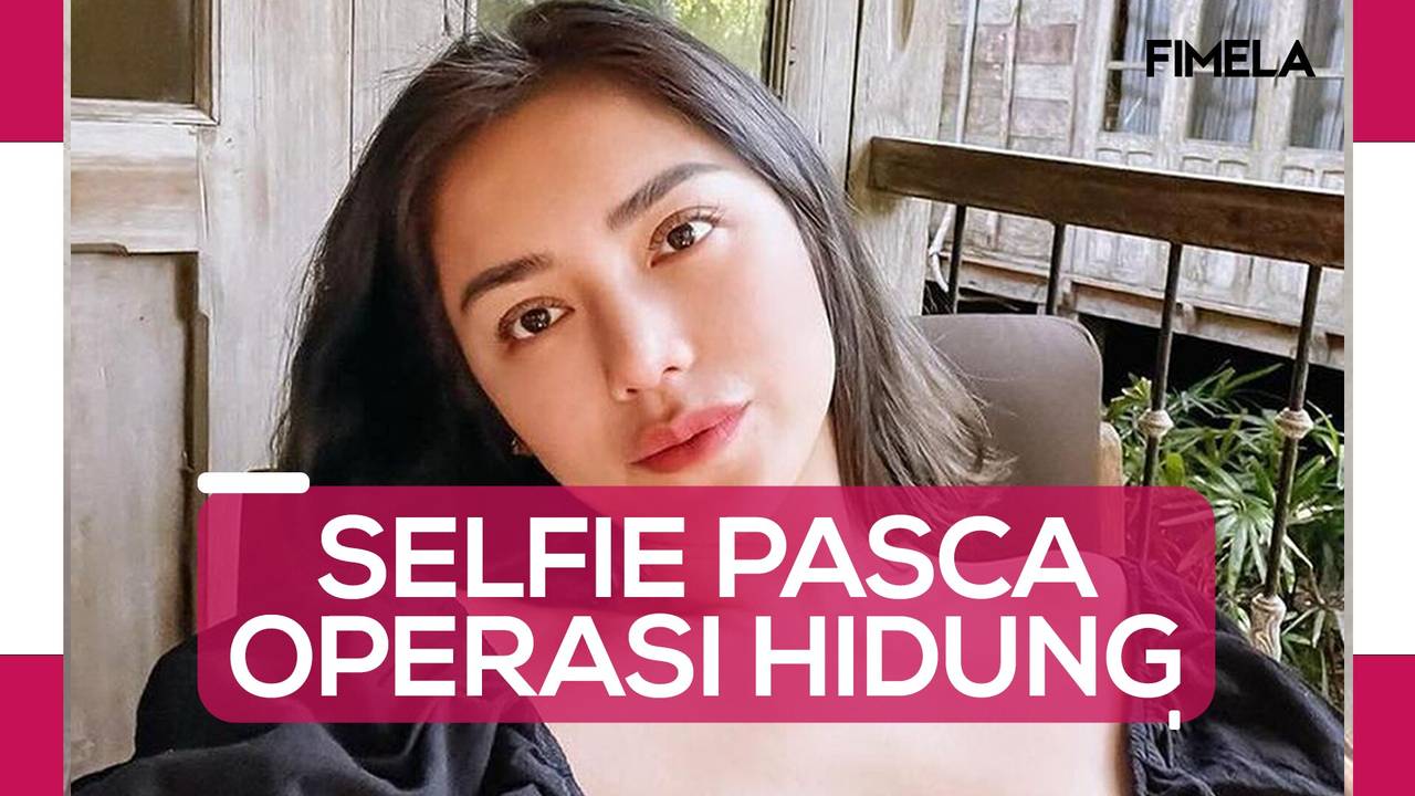 Jessica Iskandar Pamer Selfie Pasca Operasi Hidung, Dipuji Tetap ...