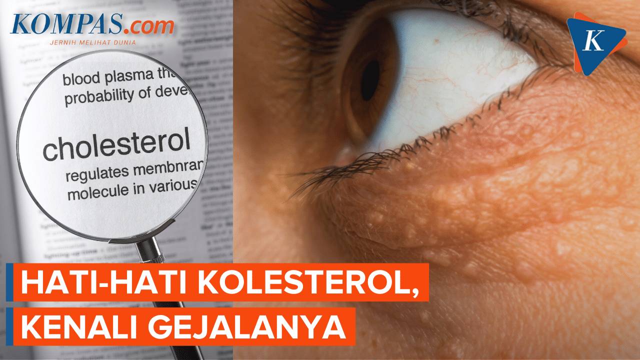 Waspada! Ini Dia Gejala Kolesterol yang Muncul di Kulit - Kompascom | Vidio