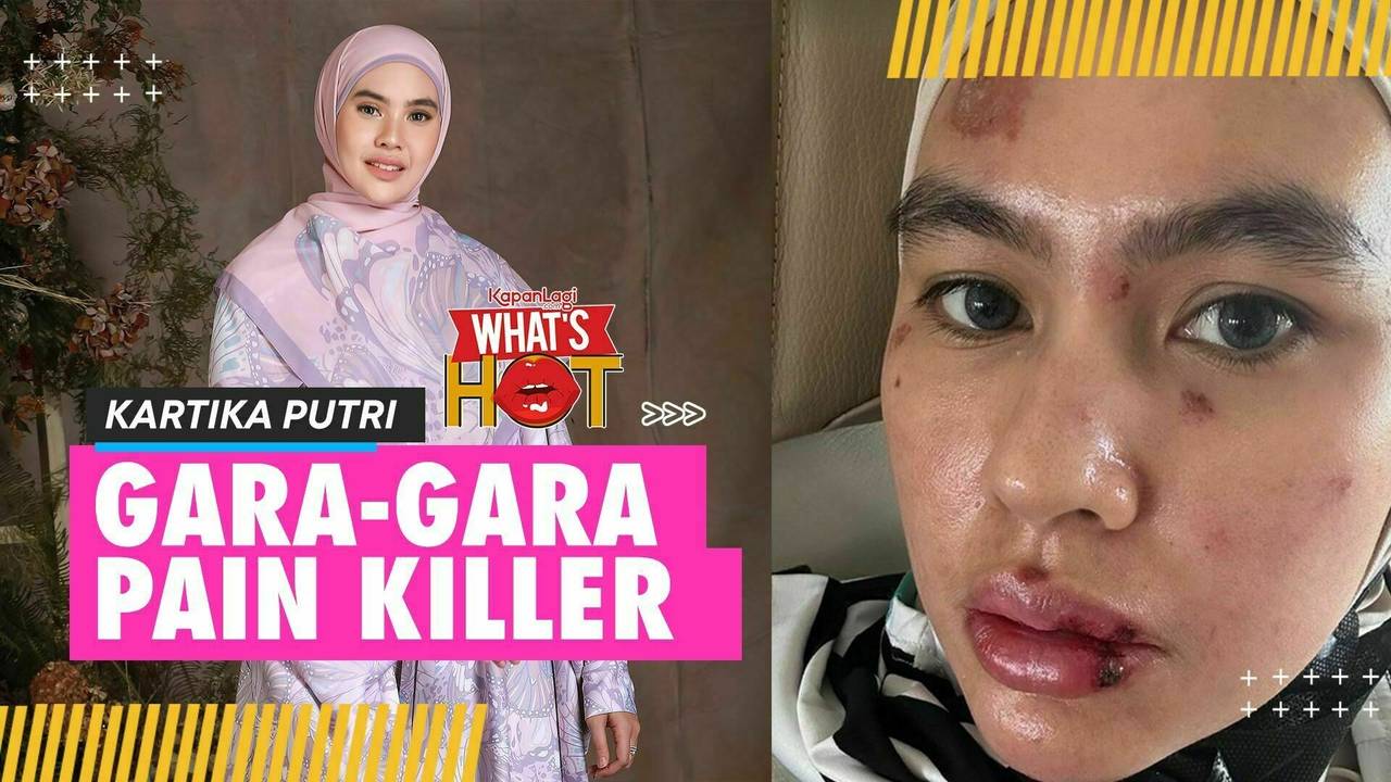 Klarifikasi Lengkap Kartika Putri Soal Wajahnya, 5 Tahun Idap Autoimun ...