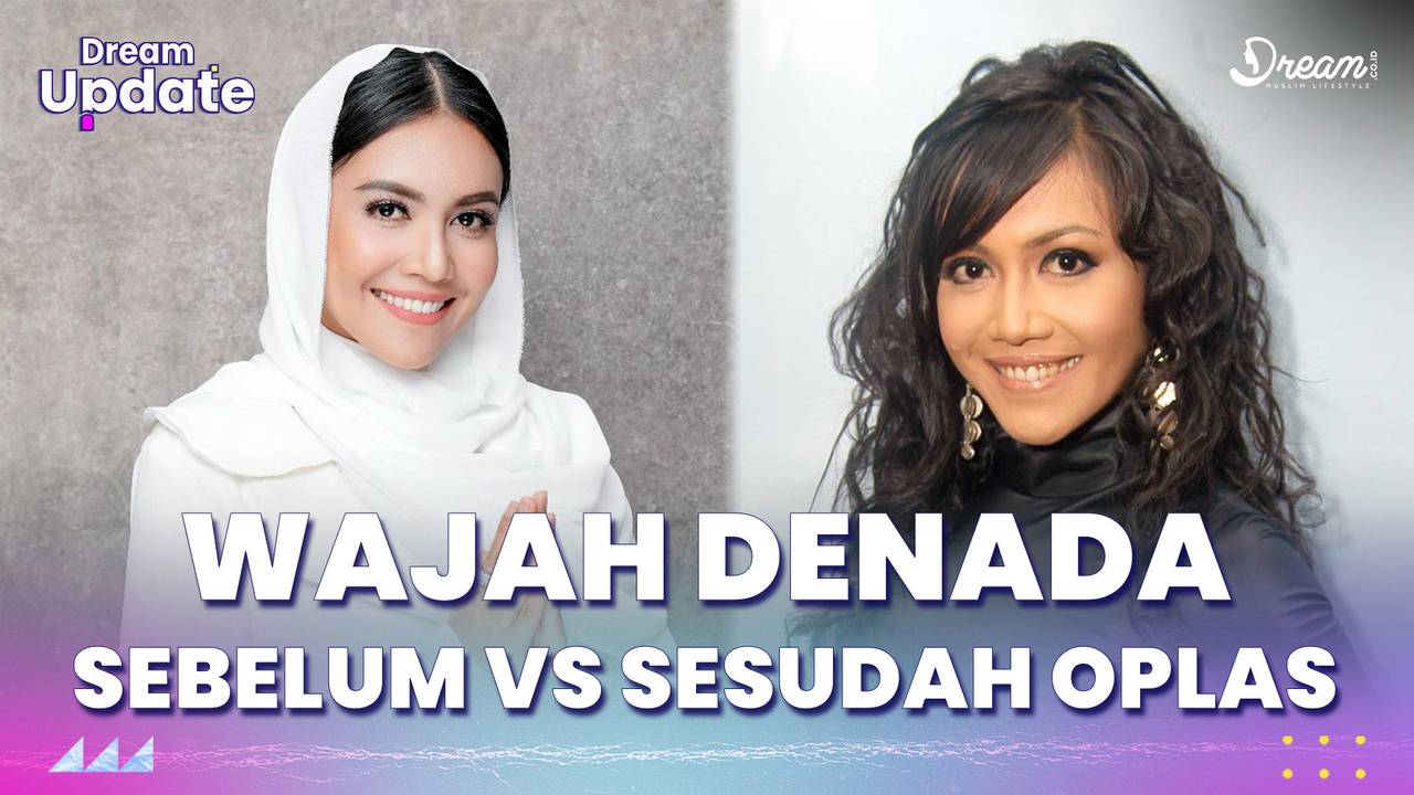 Potret Wajah Denada Sebelum VS Sesudah Oplas
