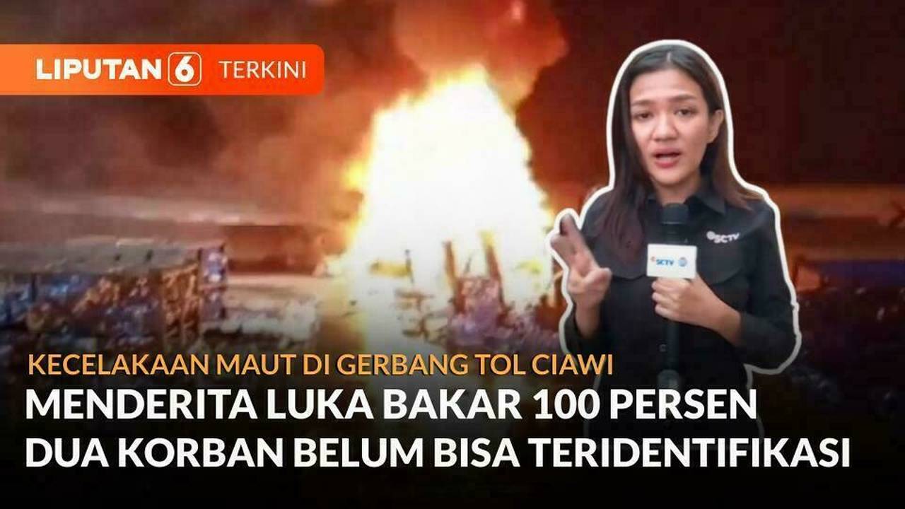 Luka Bakar 100 Persen, Dua Korban Kecelakaan Maut GT Ciawi Belum Bisa ...