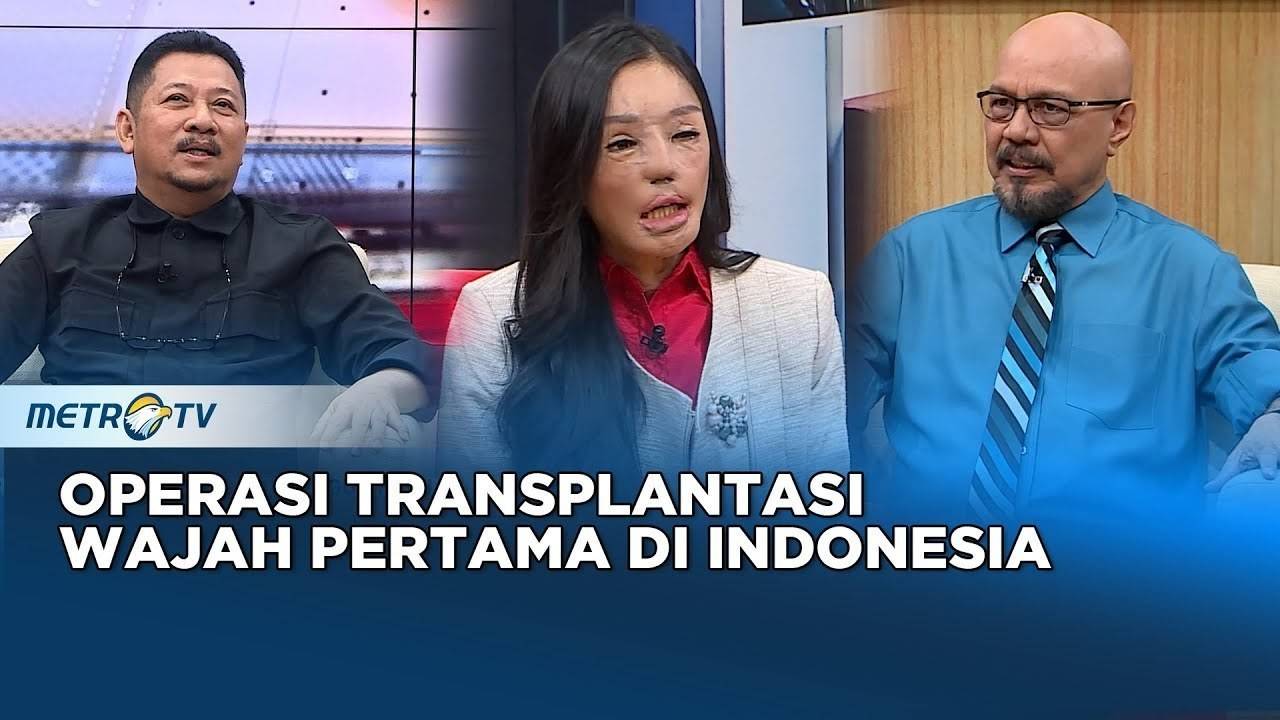 Catat Sejarah, Operasi Transplantasi Wajah Pertama di Indonesia # ...