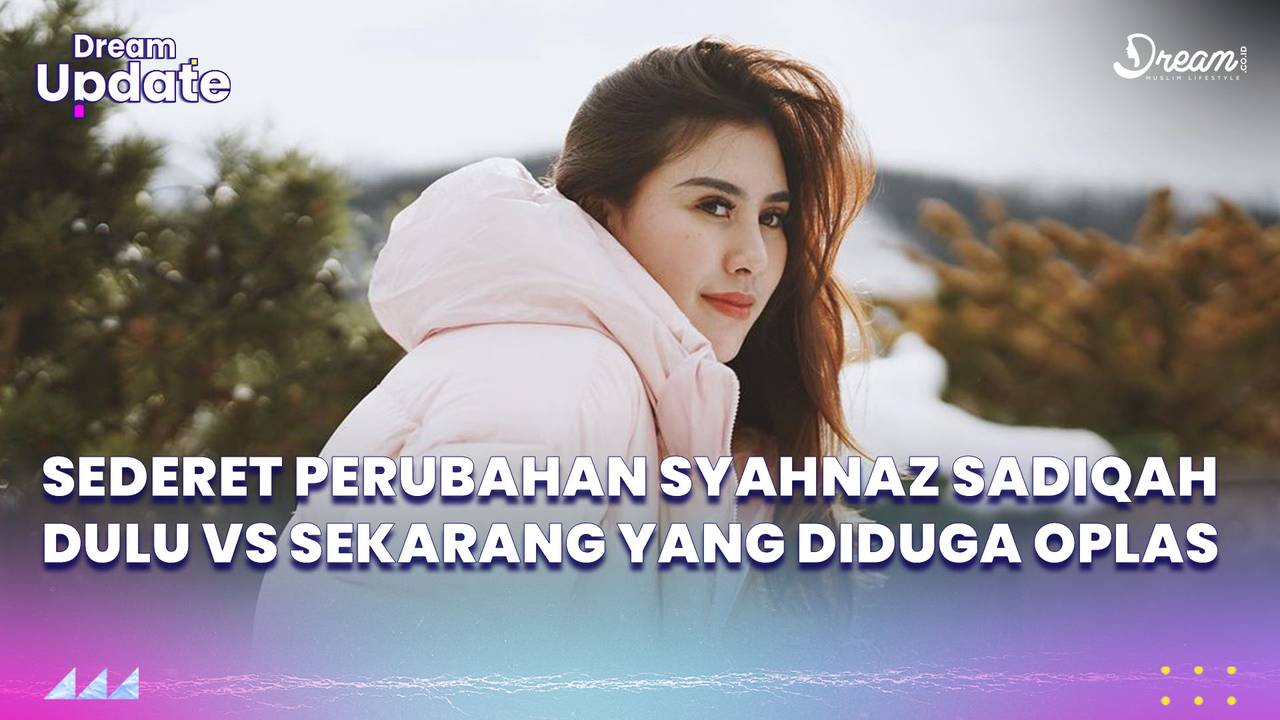 Sederet Perubahan Syahnaz Sadiqah Dulu vs Sekarang yang Diduga Oplas