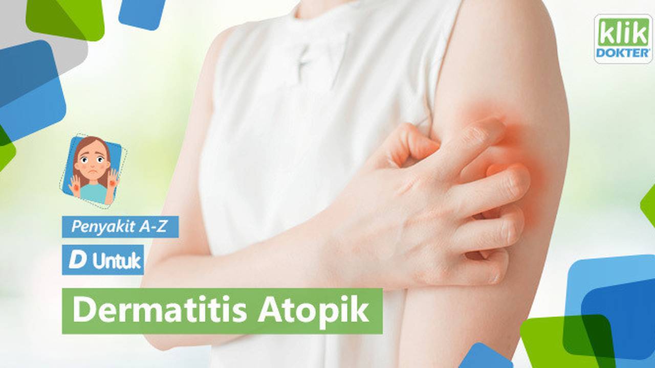 Dermatitis Atopik