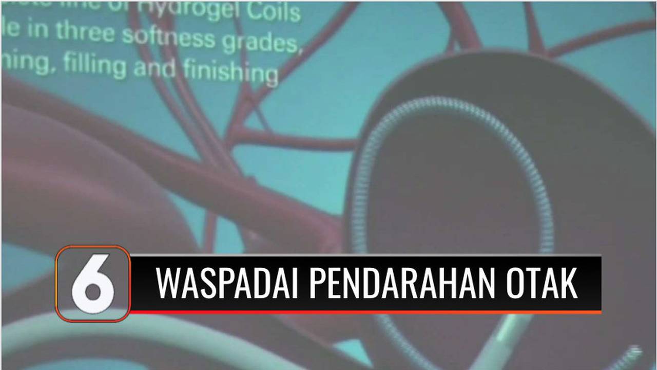 Usia 30-50 Rawan Pendarahan Otak, Hipertensi dan Merorok Diduga Jadi ...