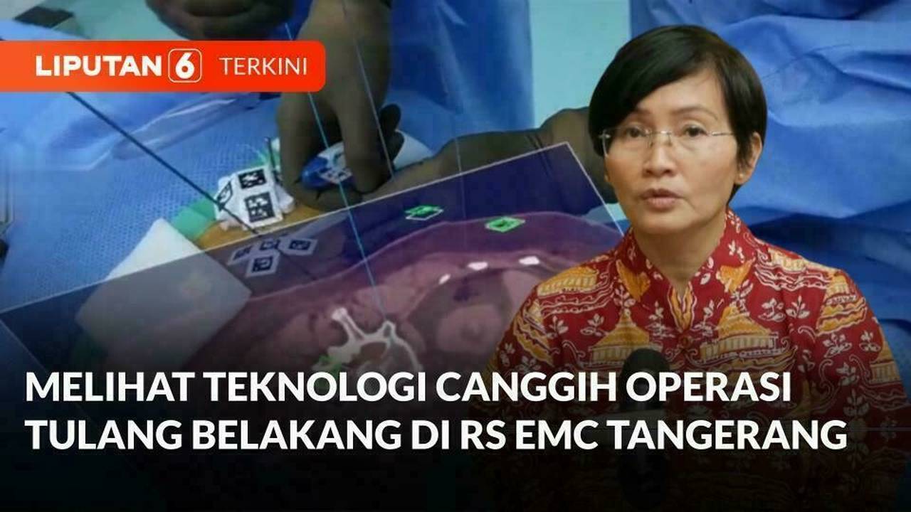 Teknologi Eagle Eye Untuk Operasi Tulang Belakang Milik RS EMC ...