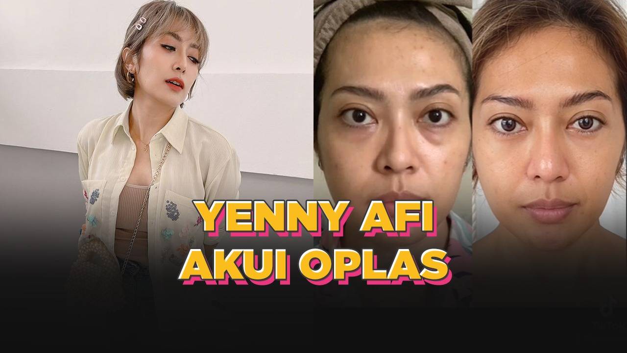 Transformasi Yenny AFI yang Jujur Akui Oplas | Vidio