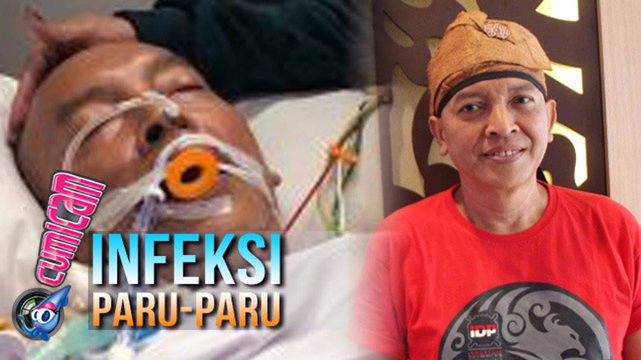 Ekki Soekarno Divonis Infeksi Paru-paru, Soraya Haque Syok | Vidio